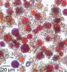 Tiny Pink Algae May Have a Big Impact on Arctic Melting - Inside ...