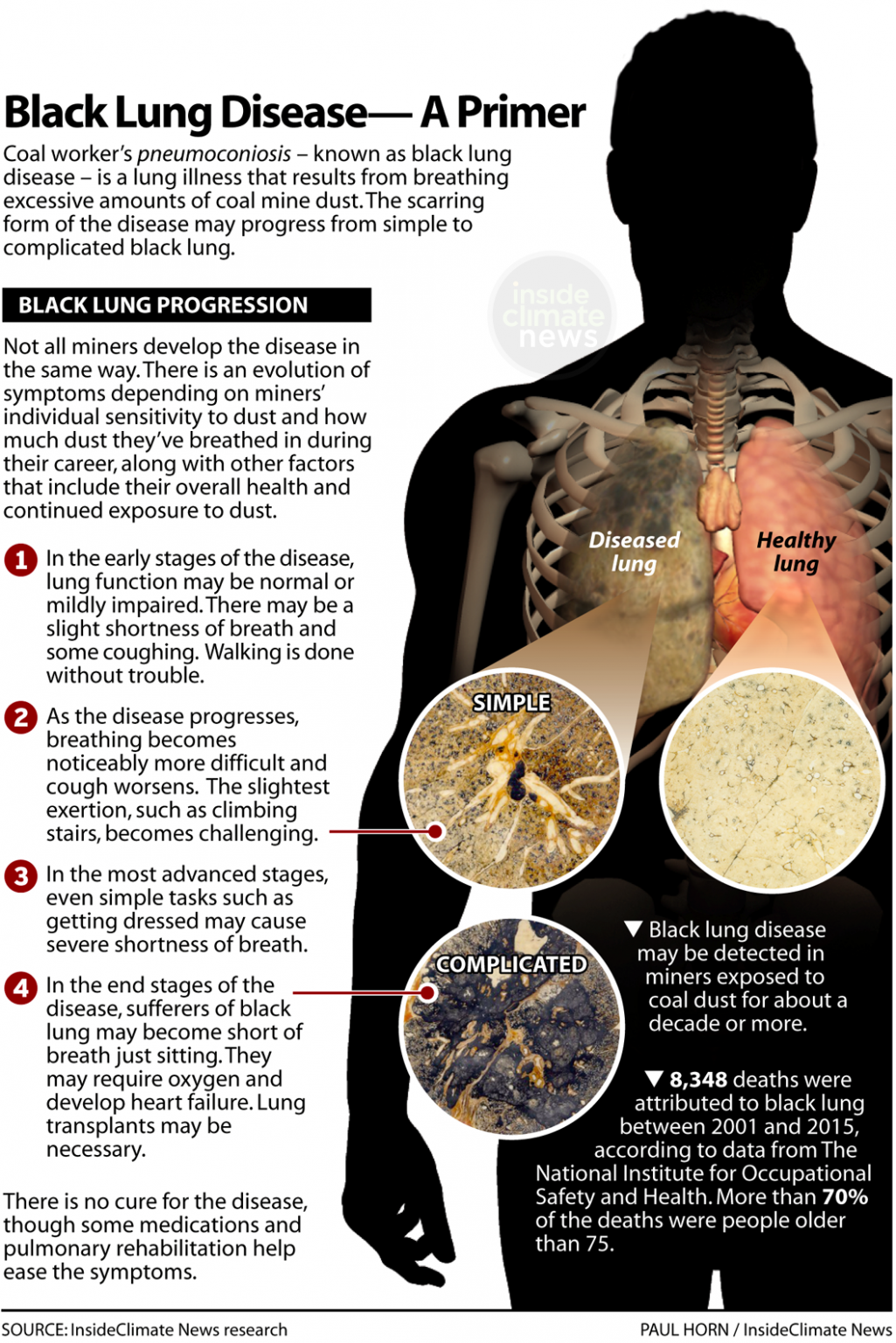 It Took This Coal Miner 14 Years to Secure Black Lung Benefits. How ...