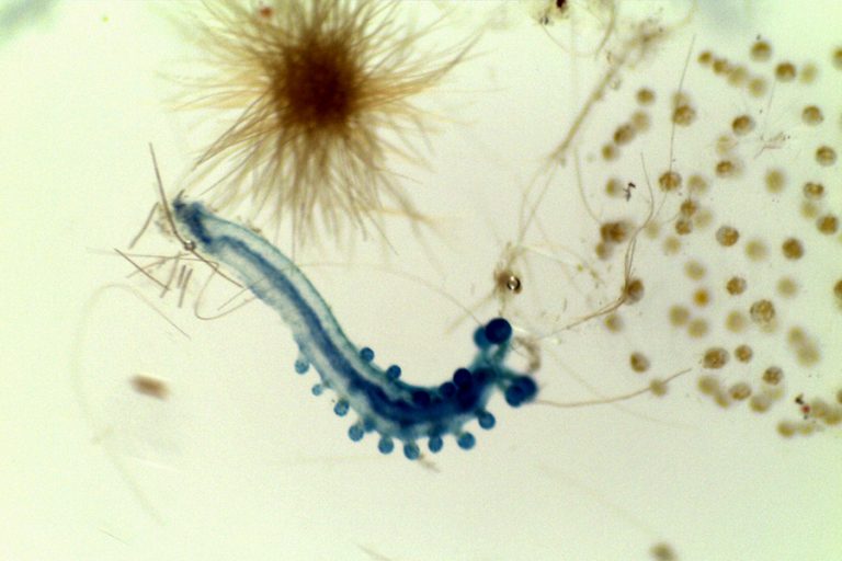 Global Warming Pushes Microbes into Damaging Climate Feedback Loops ...